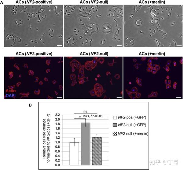 神经纤维瘤病 2 型神经鞘瘤小鼠模型的基因替代疗法 - 知乎