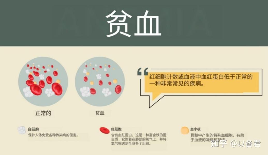 《贫血的分类及诊断，如何看血常规报告？》 知乎