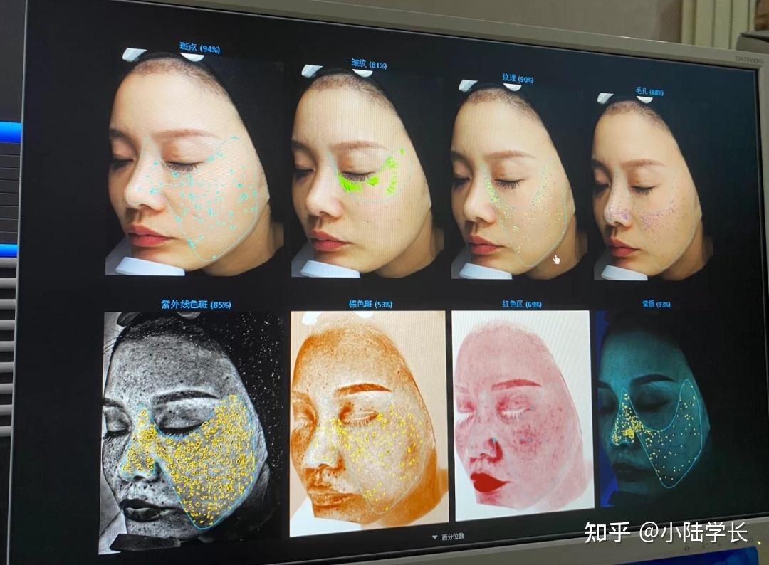 教你如何看懂visa皮肤报告！简单易懂~ - 知乎