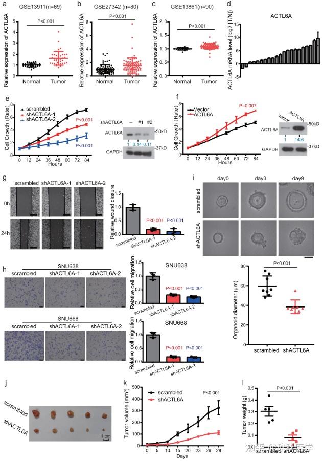 FI 16+铁死亡研究深度解读 | ACTL6A或是胃癌治疗新靶点 - 知乎