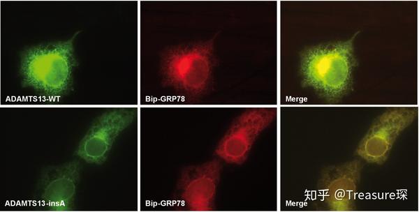 ImageJ实用技巧——荧光&明场图片合并和分割(基本功能篇) - 知乎
