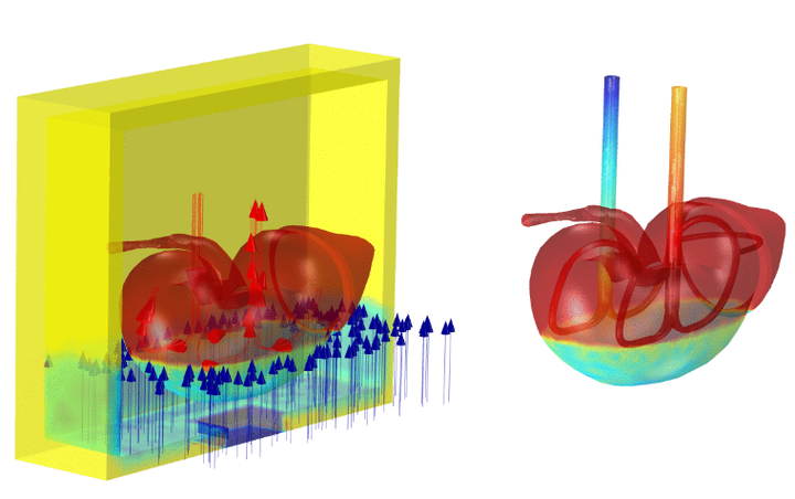 基于cosmol的肾脏移植机器低温灌洗保存法保存箱分析 - 知乎