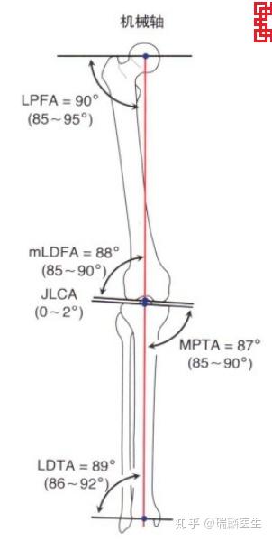 《矫形外科原则》读书笔记（二）-胫骨机械轴及解剖轴分析 - 知乎