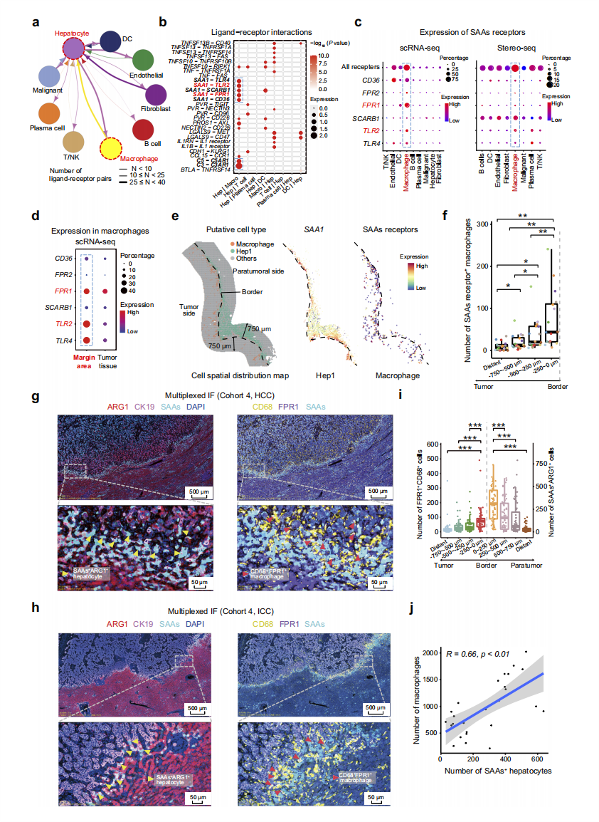 Cell Res | Stereo-seq揭示人类肝癌浸润区促进肝细胞-肿瘤细胞串扰、局部免疫抑制和肿瘤进展 - 知乎