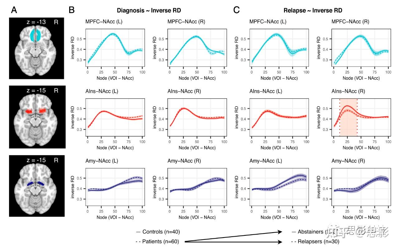 PNAS：大脑纤维束预测兴奋剂复用 - 知乎
