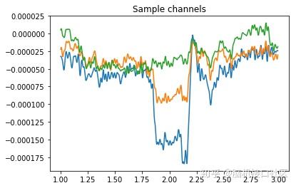 MNE-python读取.edf文件 - 知乎