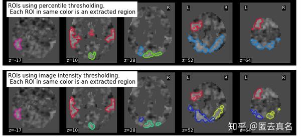 nilearn 笔记（16） - 知乎