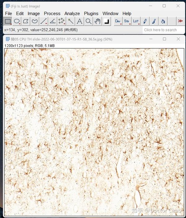 Image J 统计免疫组化片子阳性信号的平均光密度值教程 - 知乎