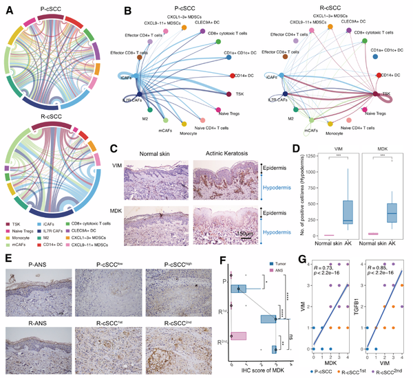 项目文章 | 单细胞测序揭示皮肤鳞状细胞癌复发相关的免疫微环境变化 - 知乎