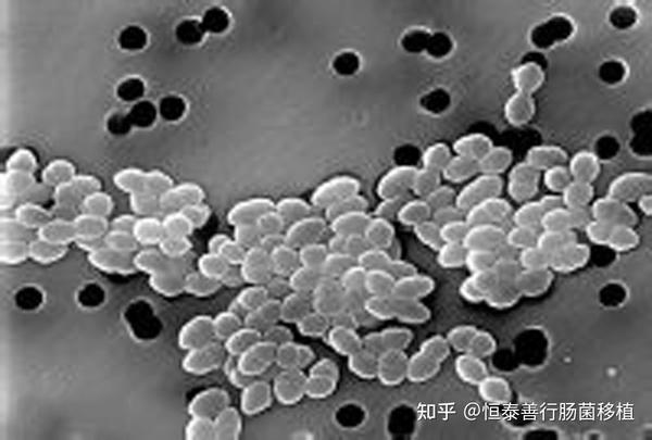 粪球菌属 Coprococcus - 知乎