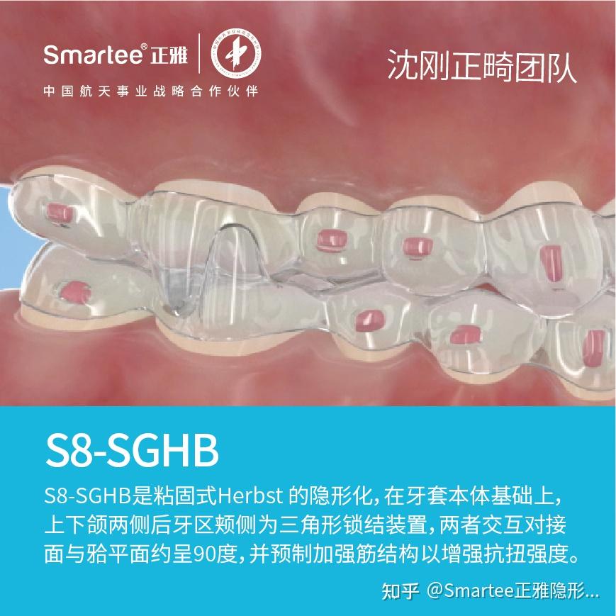 正雅答疑丨S8-SGTB与S8-SGHB的共同点和区别是什么？ - 知乎