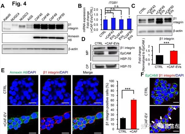 火爆全网的癌症相关成纤维细胞(CAF)最全面总结 - 知乎