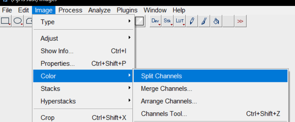 看完这篇，荧光共定位分析就没问题了！ - 知乎