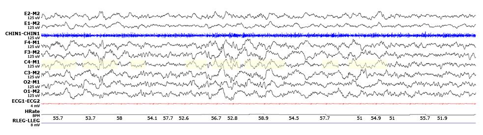 正常睡眠的分期和结构 - 知乎
