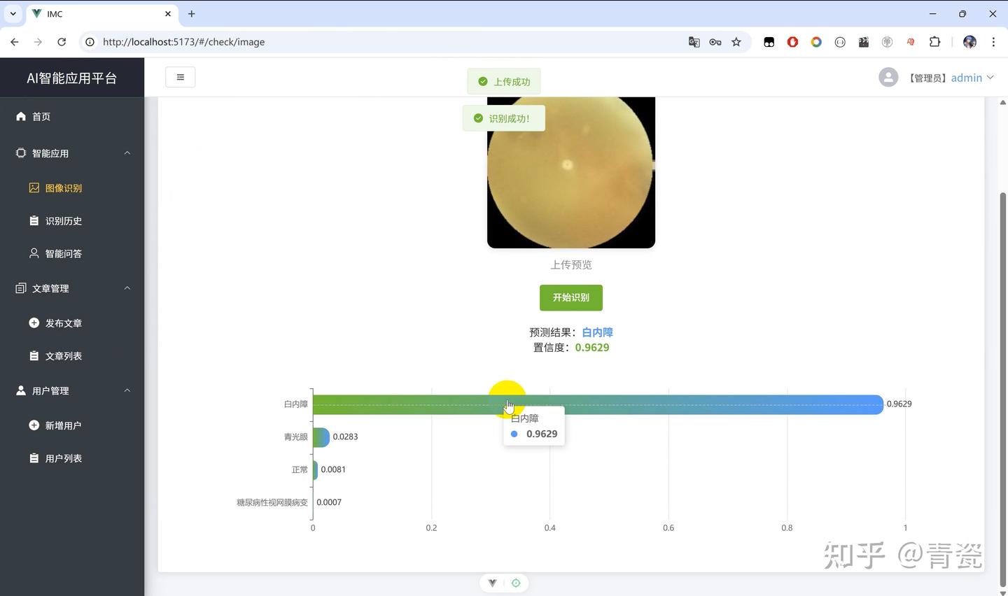 眼疾识别系统【最新版】Python+TensorFlow+Vue3+Django+人工智能+深度学习+卷积神经网络算法 - 知乎