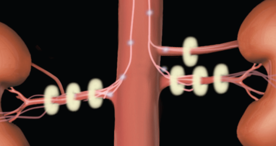 RDN产品赛道，谁将成为领头羊？ - 知乎