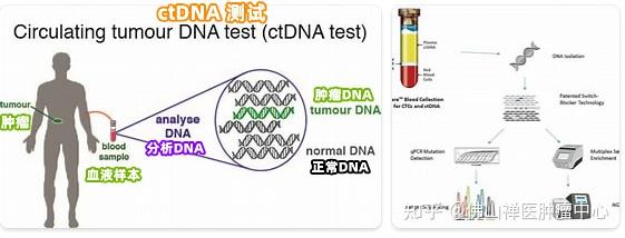了解循环肿瘤DNA（ctDNA）的临床应用 - 知乎