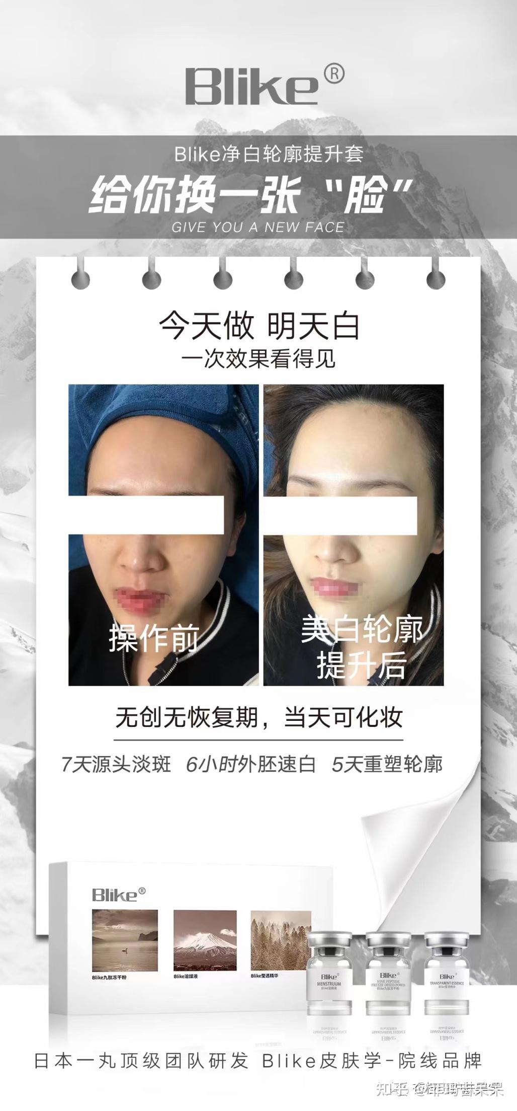 Blike净白轮廓提升套科普 - 知乎