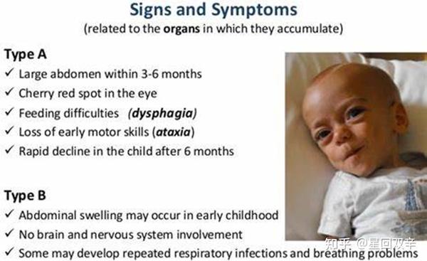 Niemann-Pick disease - 知乎