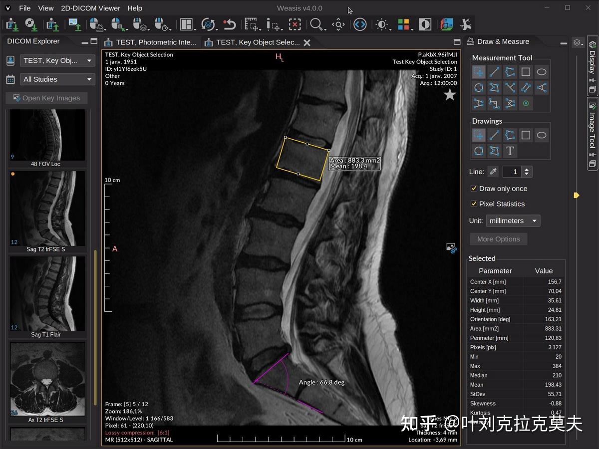 开源科学工程技术软件介绍16 – DICOM医学图片查看器Weasis - 知乎