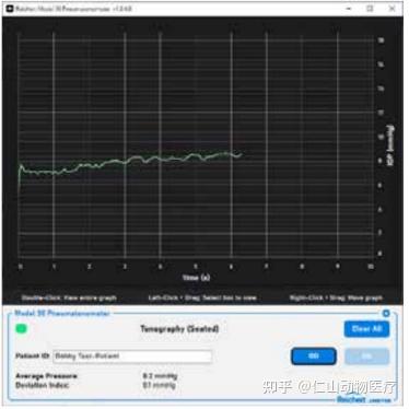 眼科产品｜美国锐科Reichert Model 30™Pneumatonometer气压眼压计 - 知乎