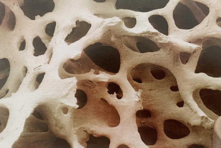 Inside bones 02 – spongy bone - 知乎