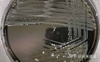 拟杆菌属重要菌种——单形拟杆菌 （Bacteroides uniformis），控制好其稳态很重要 - 知乎