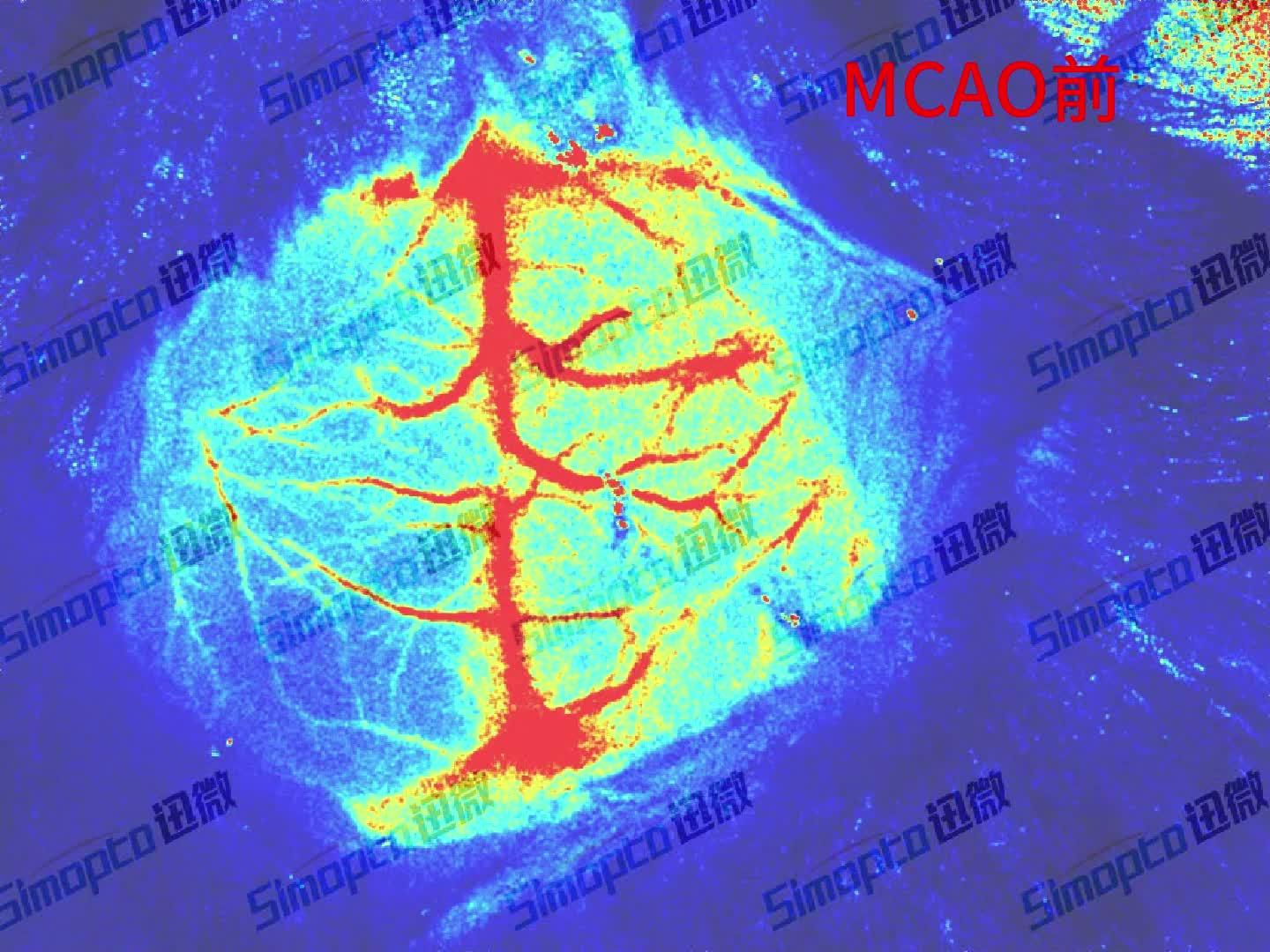大小鼠MCAO模型的评价方法 - 知乎