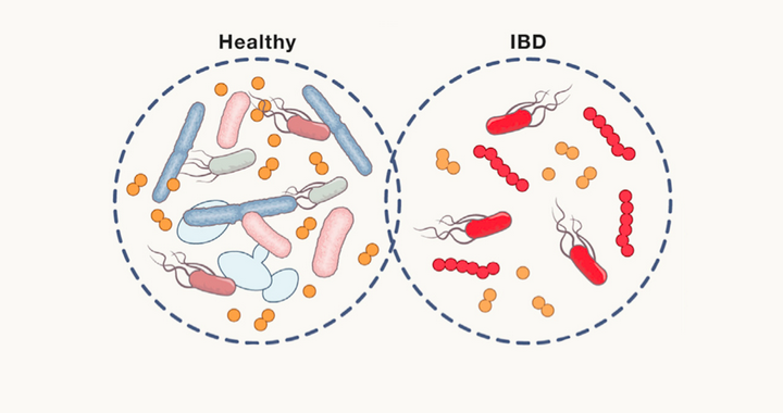 Cell重磅：基于微生物的 IBD 临床疗法新机会 - 知乎