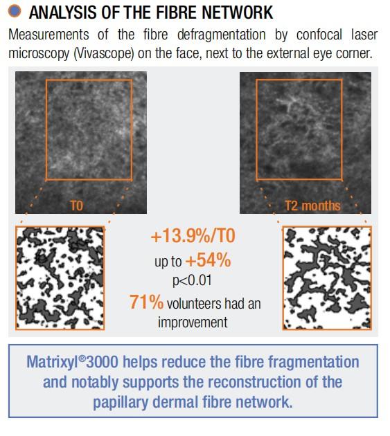 基肽3000（Matrixyl3000）为何能广泛用于抗皱抗衰护肤中？ - 知乎