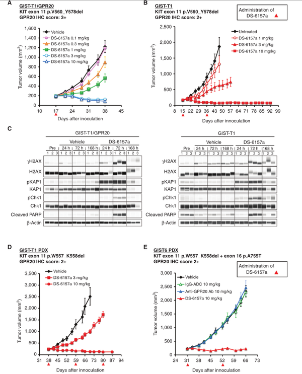 胃肠道间质瘤（GIST）的治疗新策略 - 知乎