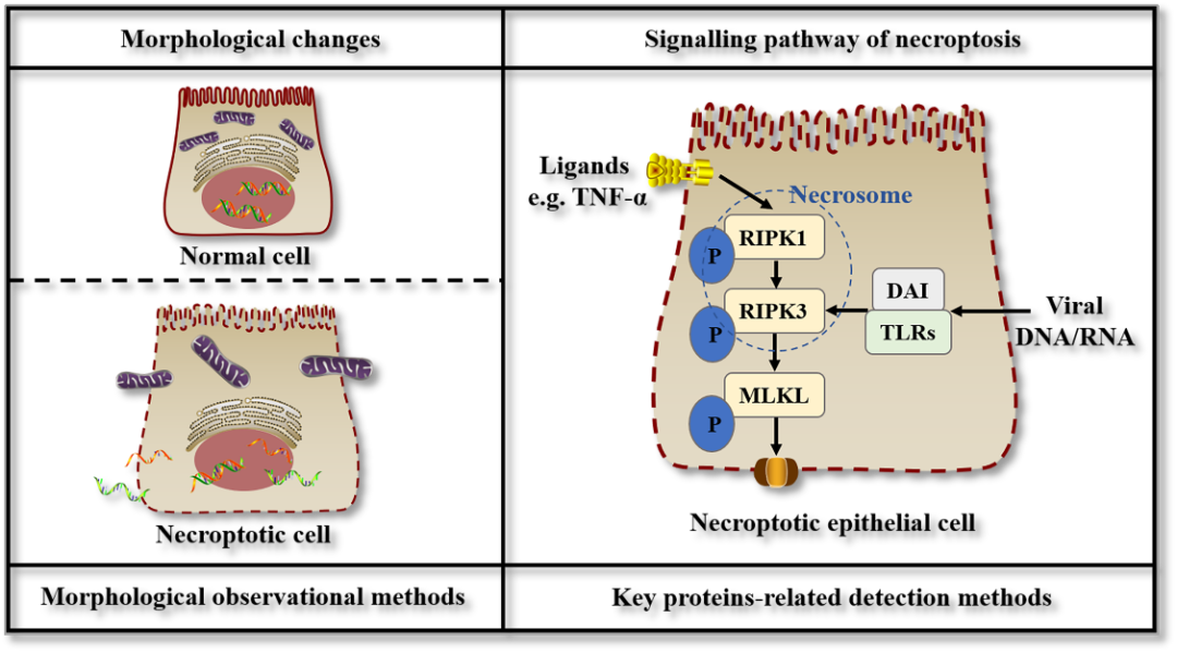 Cell Death Discov 综述︱刘晓丹团队总结坏死性凋亡对慢性阻塞性肺病气流受限的影响 - 知乎