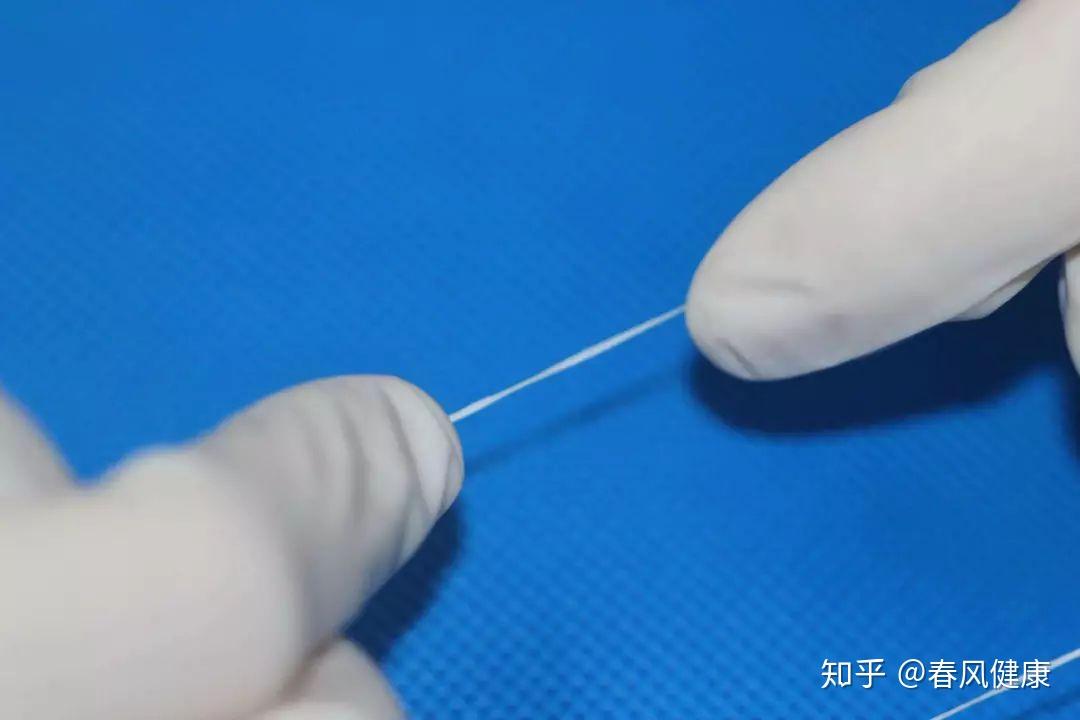 肺癌患者的静脉化疗通道-PICC篇！这些，你应该知道！ - 知乎