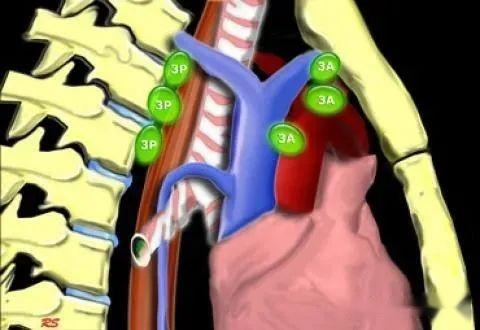 纵隔淋巴结的分区(IASLC)与诊断 - 知乎