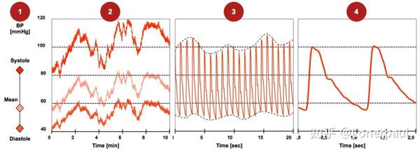 『生物信号处理』用ECG&PPG如何测血压？常见血压测量方法介绍 - 知乎
