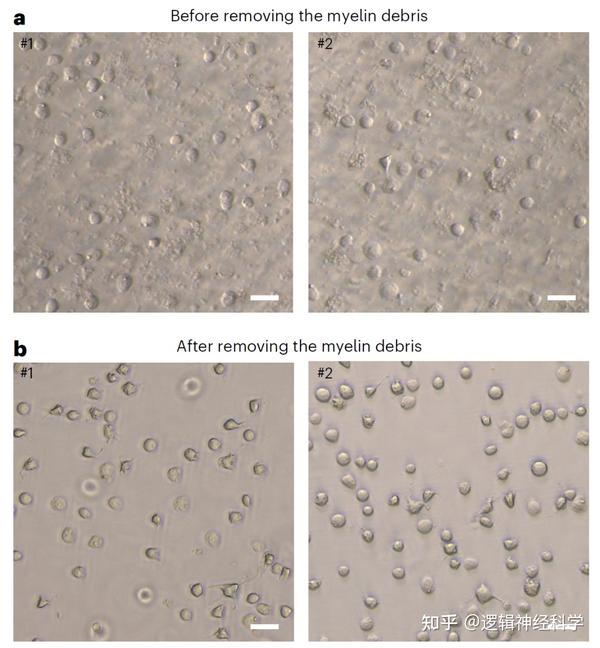 Nat Protocols︱中山大学刘胜团队开发了成年和老年灵长类脑神经细胞分离方法 - 知乎