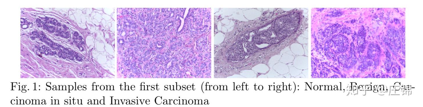 Ensembling Neural Networks for Digital Pathology Images Classification and Segmentation 阅读笔记 - 知乎