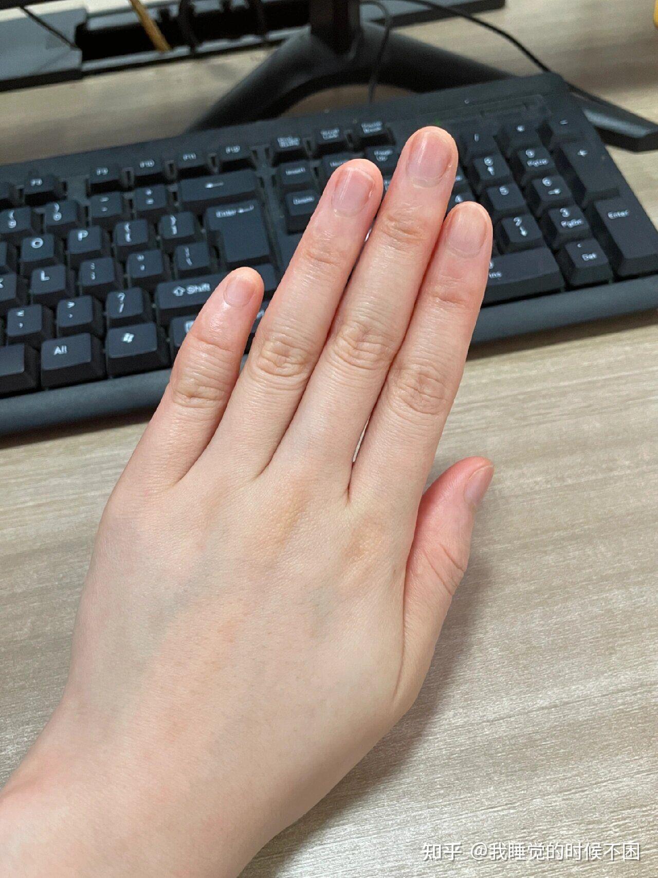 每天对着电脑十个小时的工作和学习,怎么保护眼睛呢? 知乎