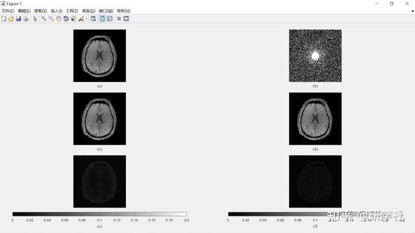 【MCTV】通过非凸总变异最小化重建凸 MR 脑图像（Matlab代码实现） - 知乎