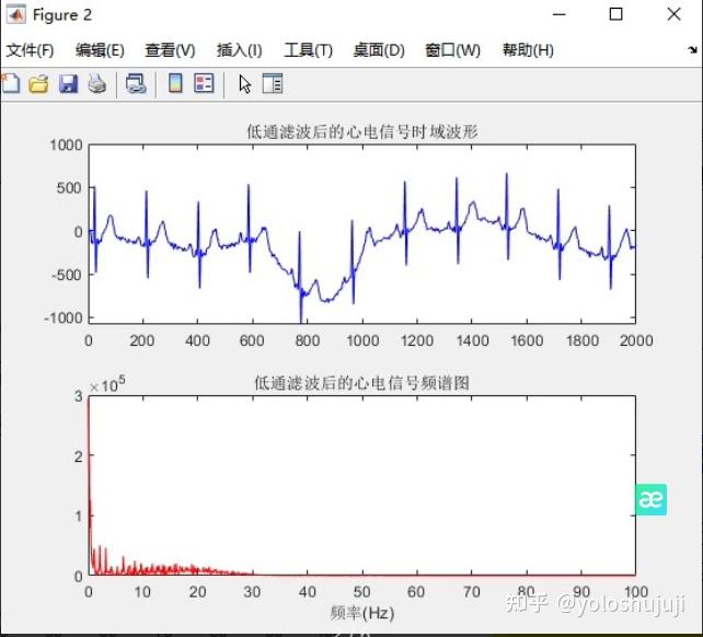 心电信号ECG去噪，Matlab程序，使用低通滤波和小波分解结合。 先去除高于80Hz的高频噪声，再去除高于50Hz的噪声和工频干扰等，最后 ...