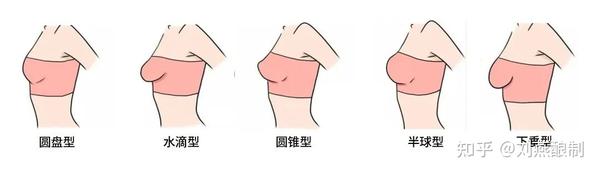 女性的胸部有多少种形状? 知乎