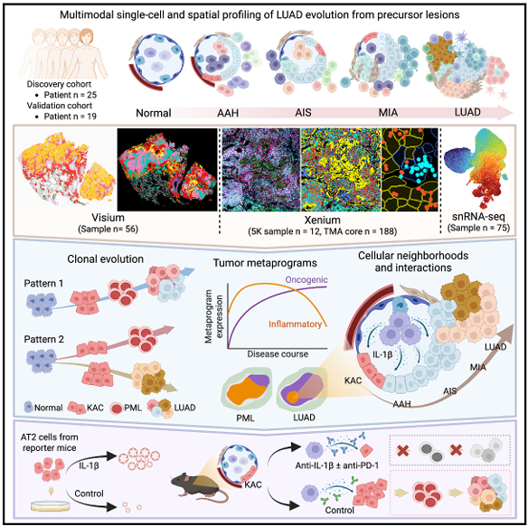 Cancer Cell文章教你做单细胞多组学联合分析scRNA/snRNA+空间转录组+WES，破解肺癌前病变恶变机制 - 知乎