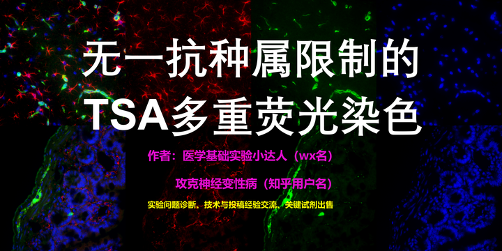 无一抗种属限制的TSA多重荧光染色技术 - 知乎