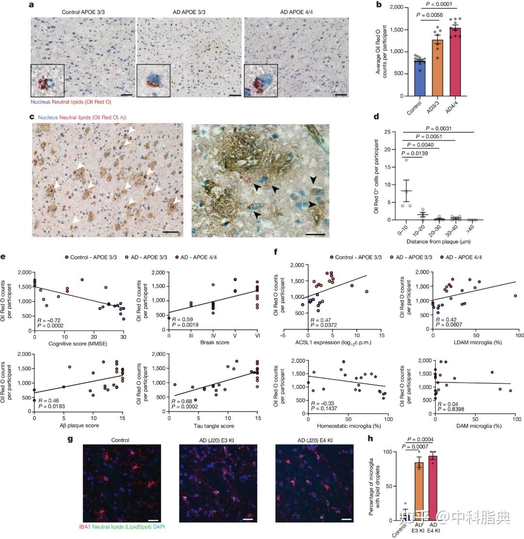 Nature：APOE4/4与阿尔茨海默病小胶质细胞损伤性脂滴有关 - 知乎