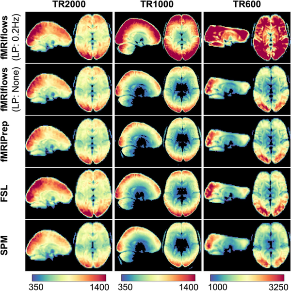 fMRIflows：全自动单变量和多变量fMRI处理管道的联合体 - 知乎