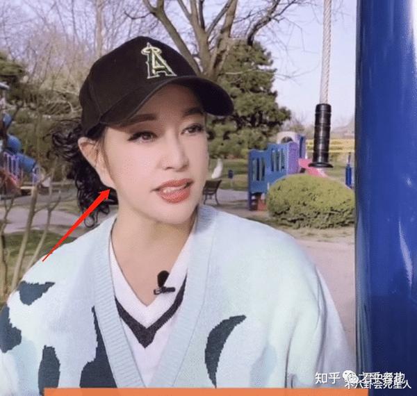 脸部僵硬，下巴歪斜，这8位老年 整容脸”明星，笑比哭还难看 知乎