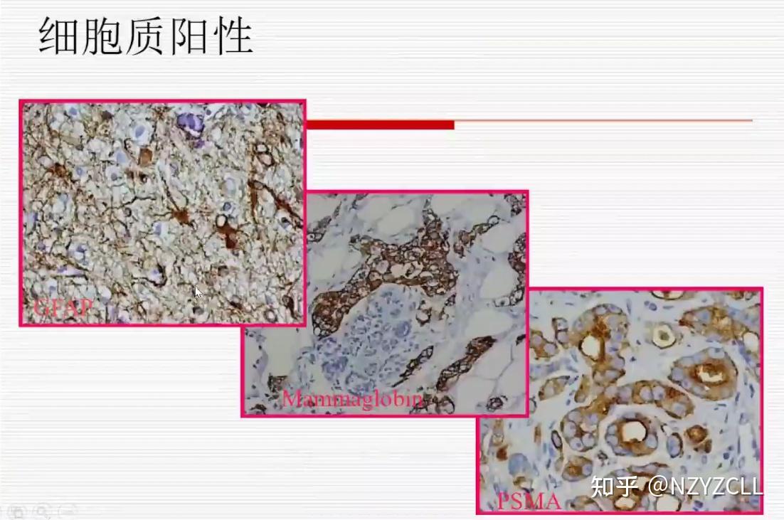 免疫组织化学实验IHC - 知乎