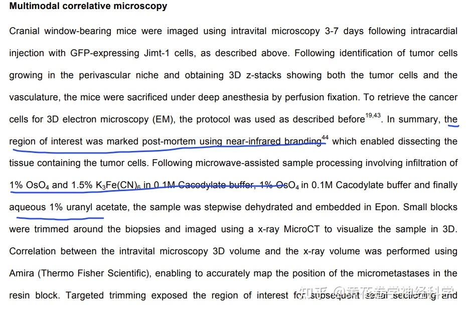 JC-Direct excitatory synapses between neurons and tumor cells - 知乎