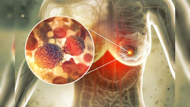 PFS翻倍！PI3K抑制剂Itovebi获FDA批准用于晚期乳腺癌 - 知乎
