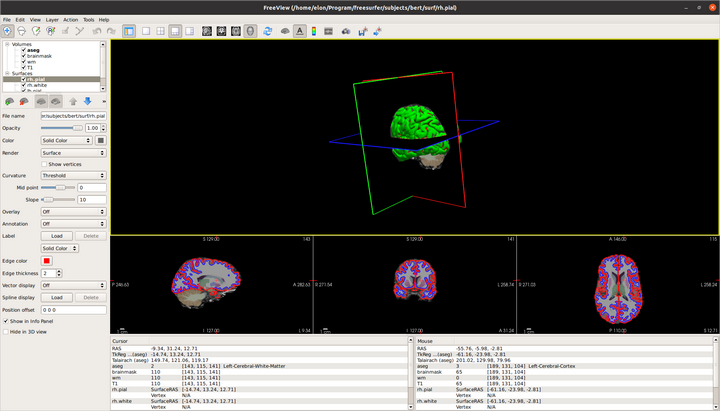 Freesurfer在Ubuntu20.04安装教程 - 知乎